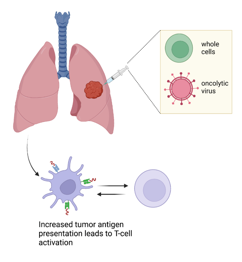 lung cancer – The Aggie Transcript